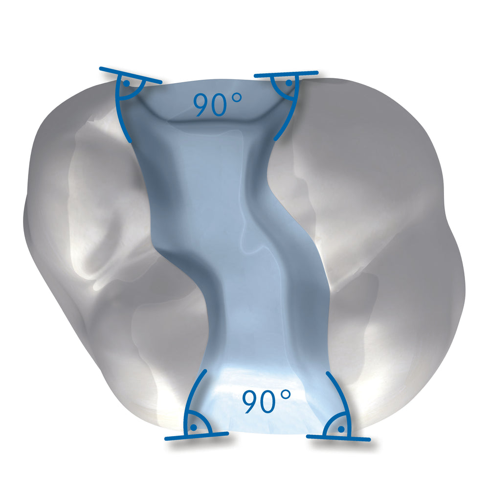 Defect-Oriented: All-Ceramic Inlays & Partial Crowns – Komet UK